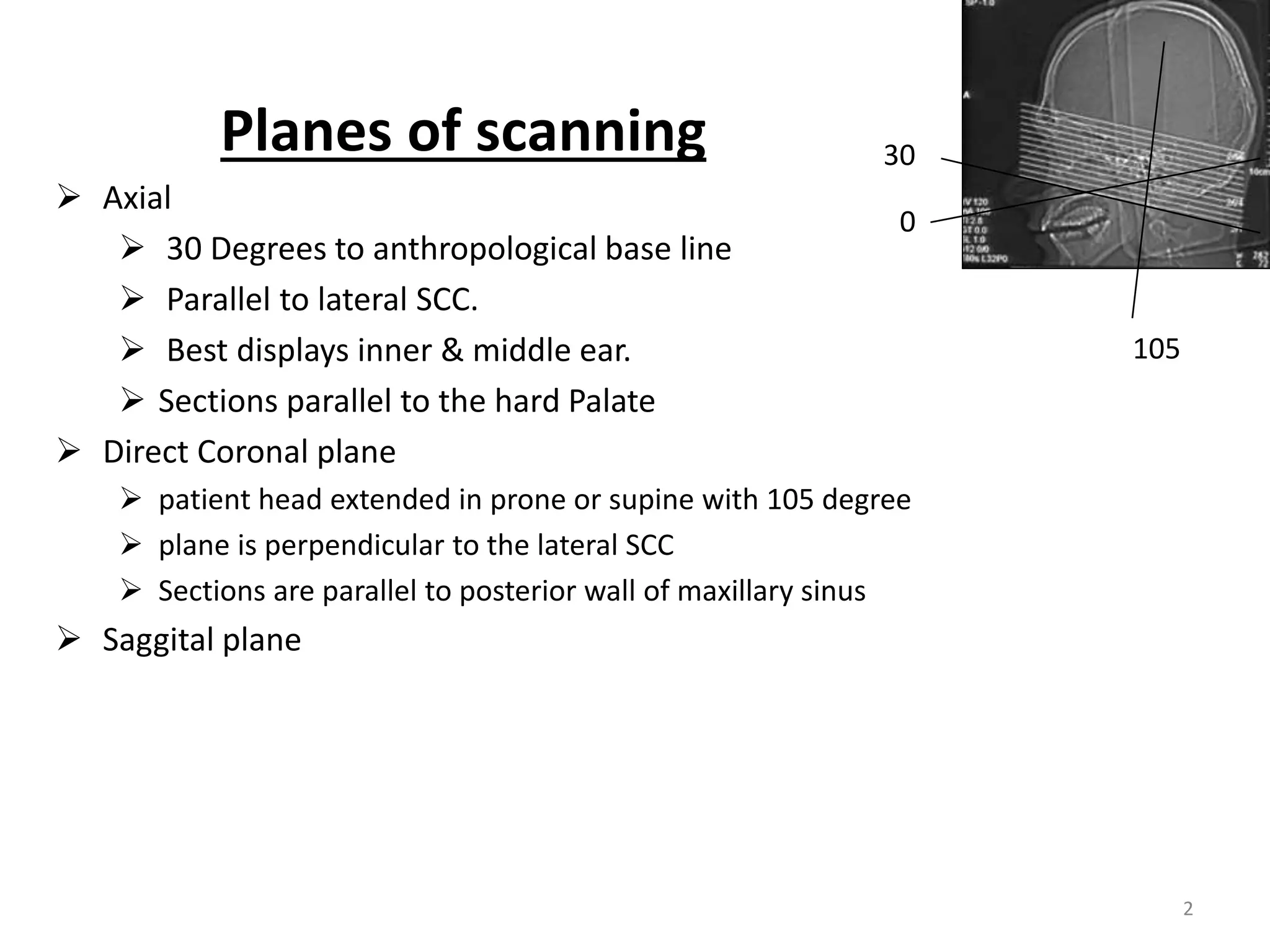 temporalbone-141009084034-conversion-gate02 (1).pdf