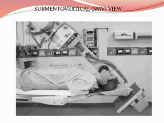 IMAGING OF TEMPORAL BONE | PPTX
