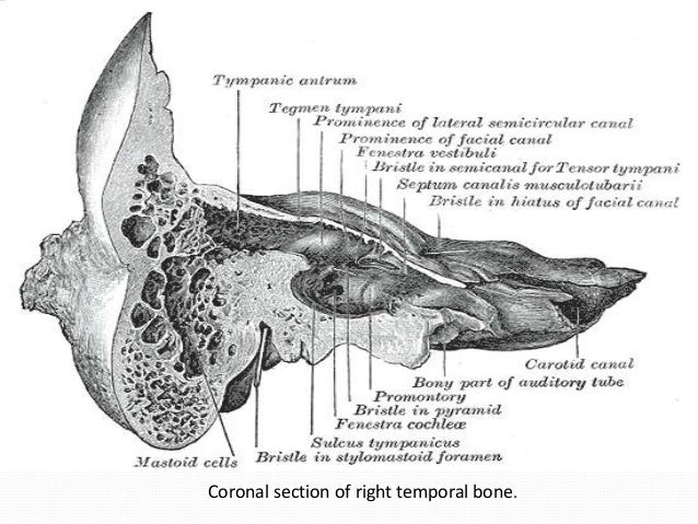 IMAGING OF TEMPORAL BONE