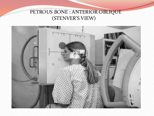 IMAGING OF TEMPORAL BONE