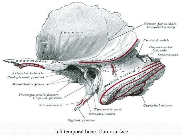 IMAGING OF TEMPORAL BONE