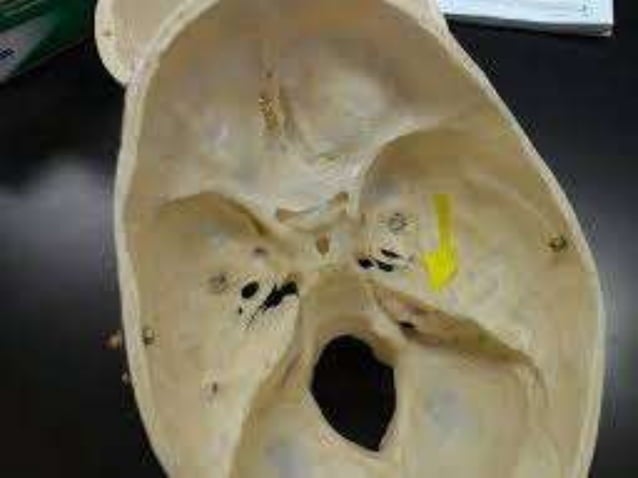 Temporal Bone and Facial Nerve Anatomy