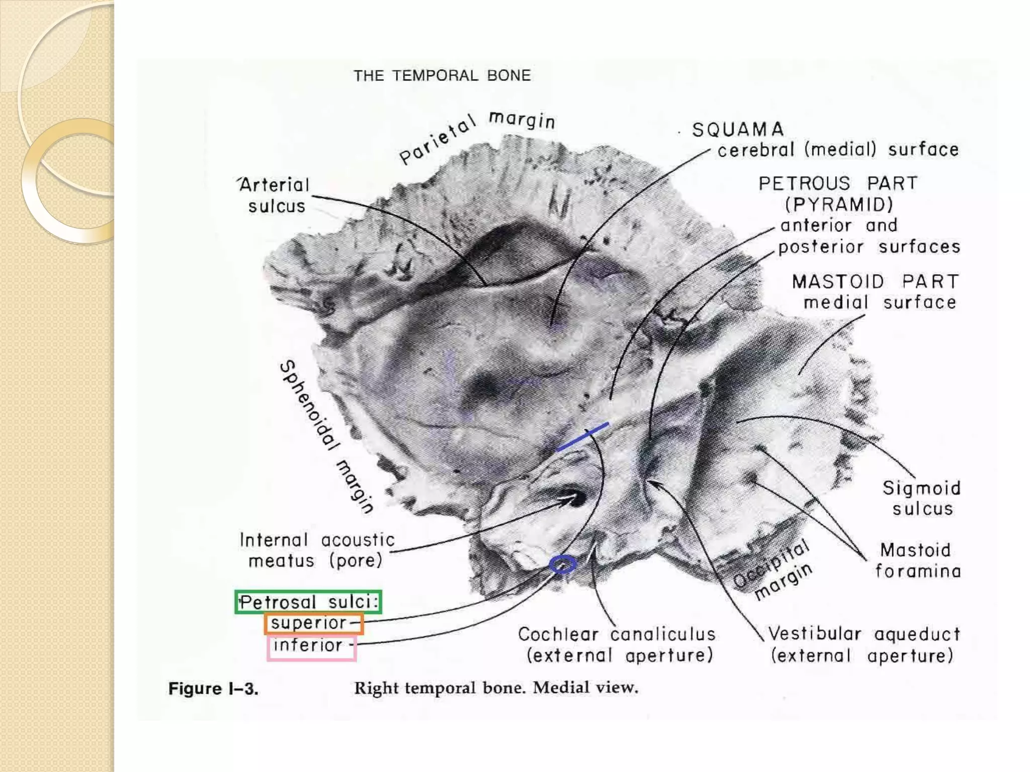 TEMPORAL BONE.pptx