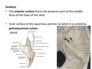 Temporal bone1 | PPT