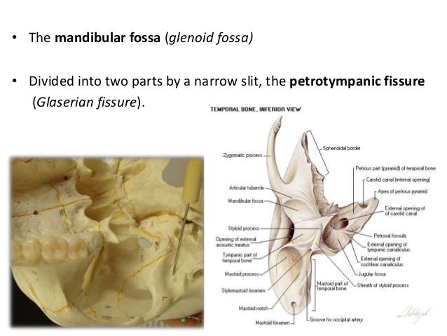 Temporal bone1