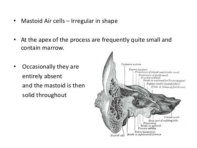 Temporal bone1