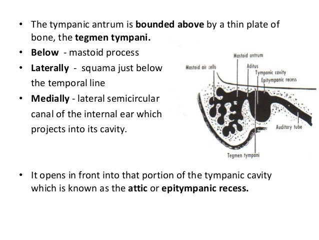 Temporal bone1
