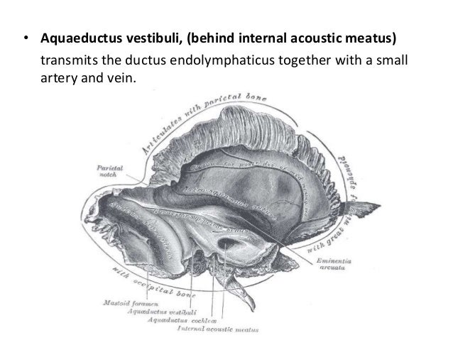 Temporal bone1