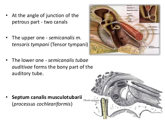 Temporal bone1