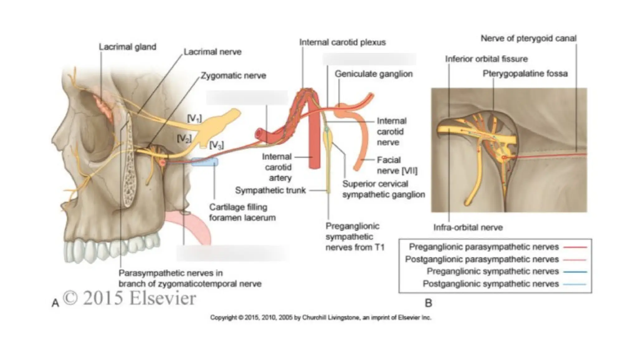 Temporal bone correction in temporal bone fracture.pptx