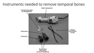 Temporal bone dissection | PPTX