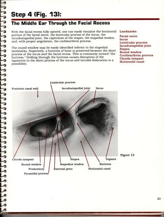 Temporal bone dissection (house) | PDF