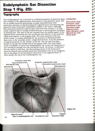 Temporal bone dissection (house) | PDF