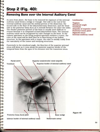 Temporal bone dissection (house) | PDF
