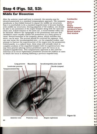 Temporal bone dissection (house) | PDF