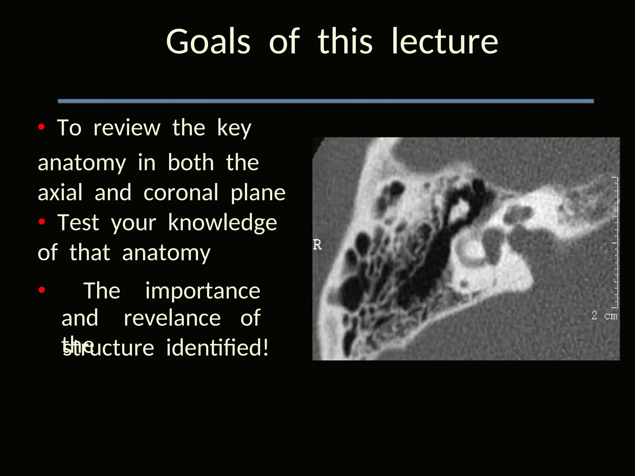 Temporal bone HRCT anatomy.ppt this ppt provides a comprehensive study ...