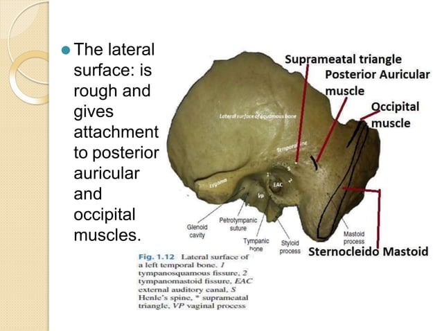 Temporal Bone anatomy ppt.pptx
