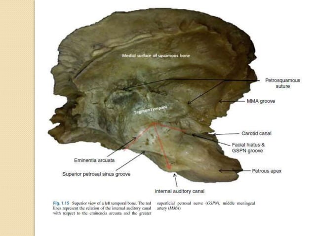 Temporal Bone anatomy ppt.pptx