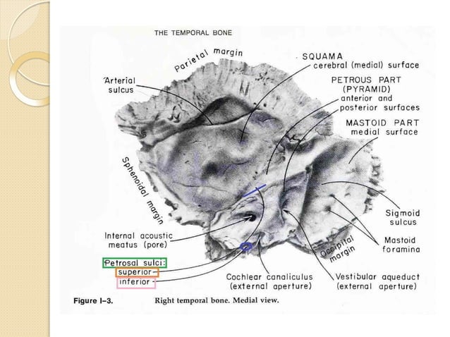 Temporal Bone anatomy ppt.pptx
