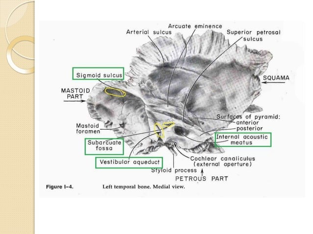 Temporal Bone anatomy ppt.pptx