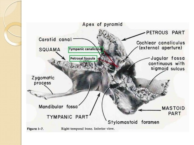 Temporal Bone anatomy ppt.pptx