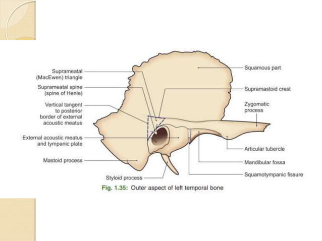 Temporal Bone anatomy ppt.pptx