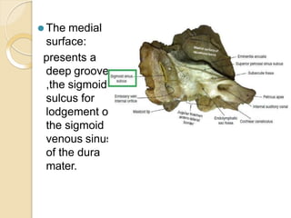 Sigmoid Sulcus