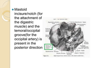 Digastric Notch Of Temporal Bone