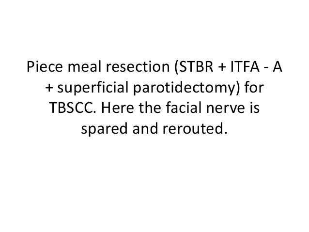 Temporal bone resection | PPT