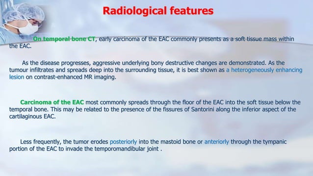 Temporal bone tumors staging and radiological assesment | PPTX | Ear ...