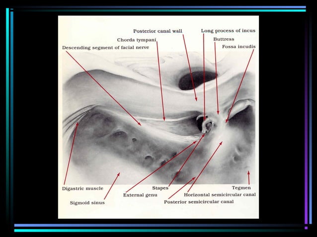 Temporal dissection | PPT