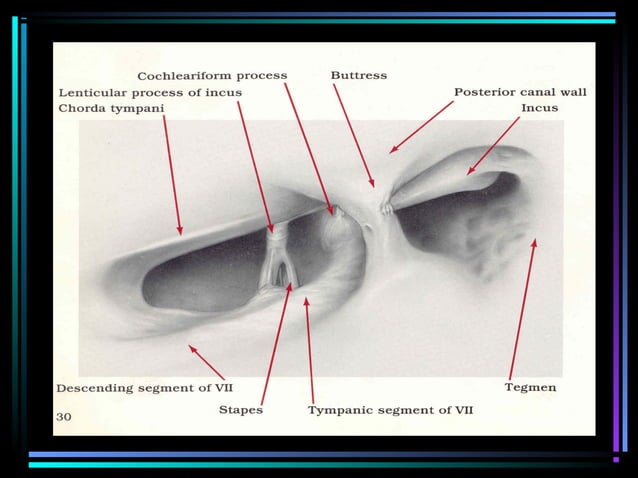 Temporal dissection | PPT