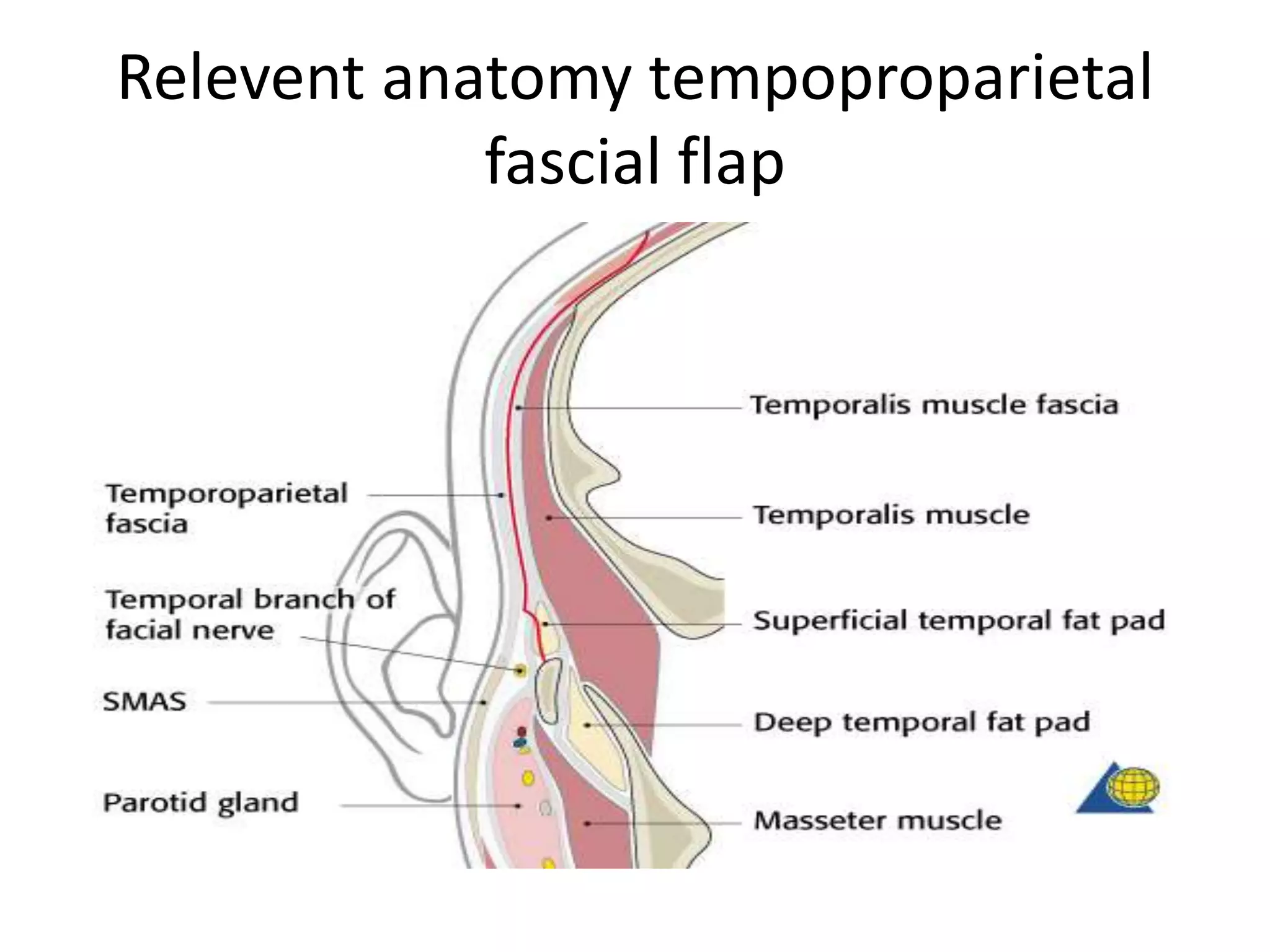 temporoparietal flaps | PPTX