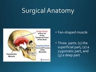 Temporalis transfer for unilateral facial nerve palsy for smile ...