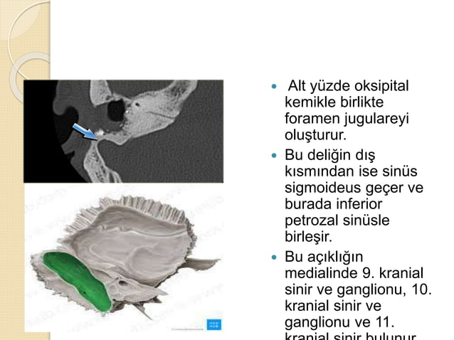 Temporal kemik anatomiisi işitme ve denge fizyolojiisi | PPTX