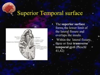 Temporal lobe | PPT