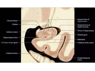temporal lobe anatomy class - Detailed anatomy | PPTX