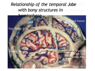temporal lobe anatomy class - Detailed anatomy | PPTX