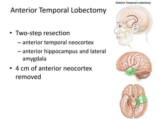 temporal lobe anatomy class - Detailed anatomy | PPTX