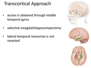 temporal lobe anatomy class - Detailed anatomy | PPTX