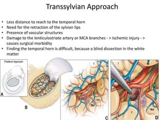 temporal lobe anatomy class - Detailed anatomy | PPTX