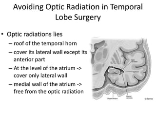 temporal lobe anatomy class - Detailed anatomy | PPTX
