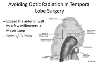 temporal lobe anatomy class - Detailed anatomy | PPTX