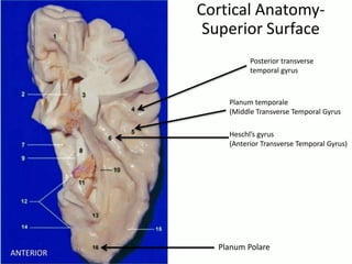 temporal lobe anatomy class - Detailed anatomy | PPTX