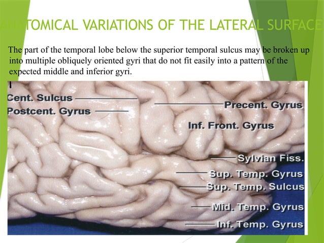 Temporal Lobe Anatomy neurosurgery fINAL.pptx