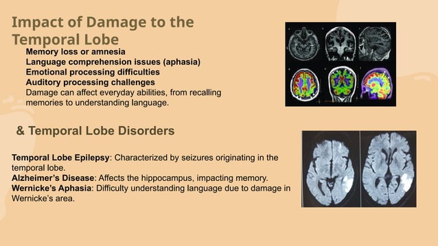 temporal lobe and its function by ashmit.pptx