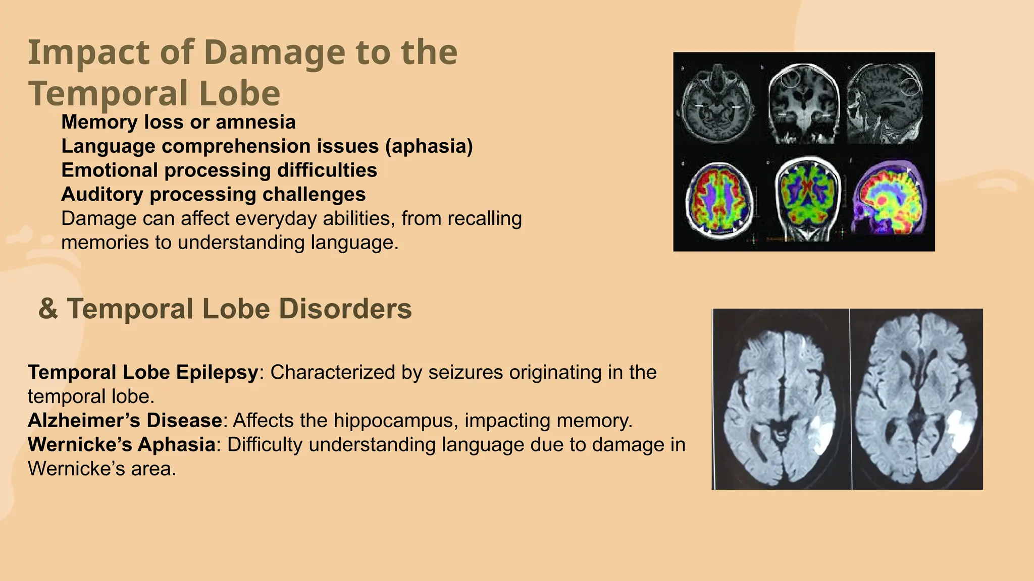 temporal lobe and its functions by ashmit.pptx
