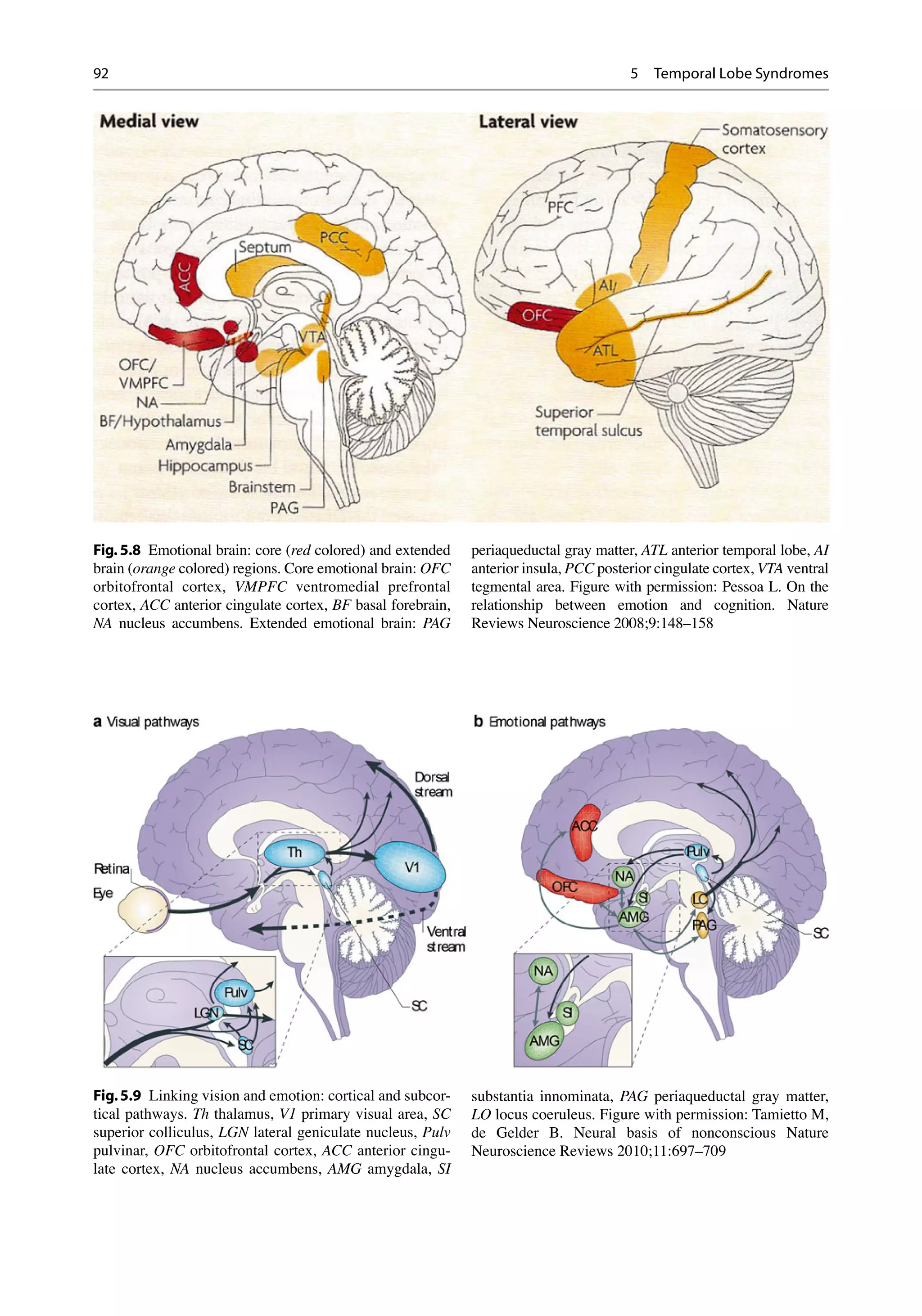 temporal lobe syndrome.pdf | Brain and Nervous System Disorders | Diseases and Conditions