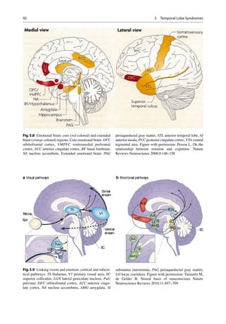 temporal lobe syndrome.pdf | Brain and Nervous System Disorders ...