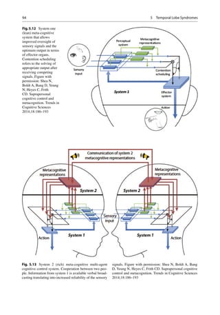 temporal lobe syndrome.pdf | Brain and Nervous System Disorders | Diseases and Conditions